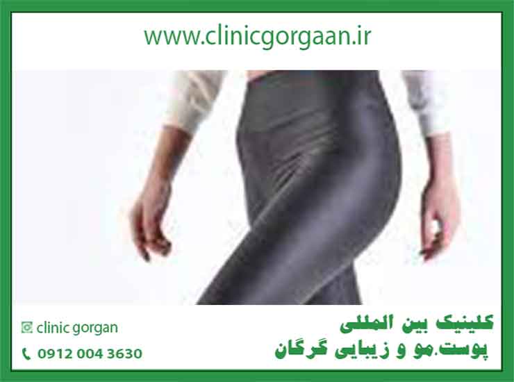 کمر باریک و باسن بزرگ کلینیک تخصصی پوست و مو زیبایی گرگان